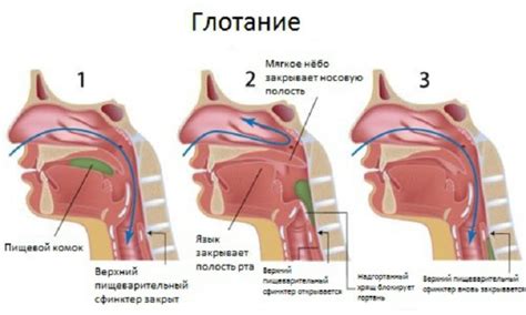 Как достать предмет из горла