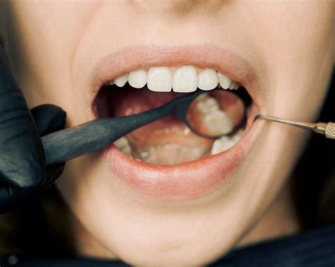 Can You Feel If You Have a Cavity? - Oral Health - Carlsbad Dentist ...