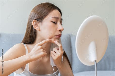 Expression worry asian young woman hand touching pustule around the chin and mouth, allergic ...