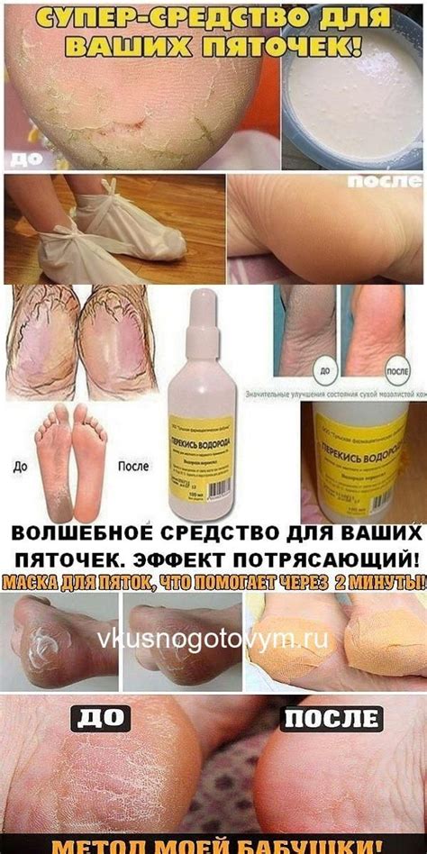 Полезные советы in 2024 | Healthy eating, Natural health, Health tips