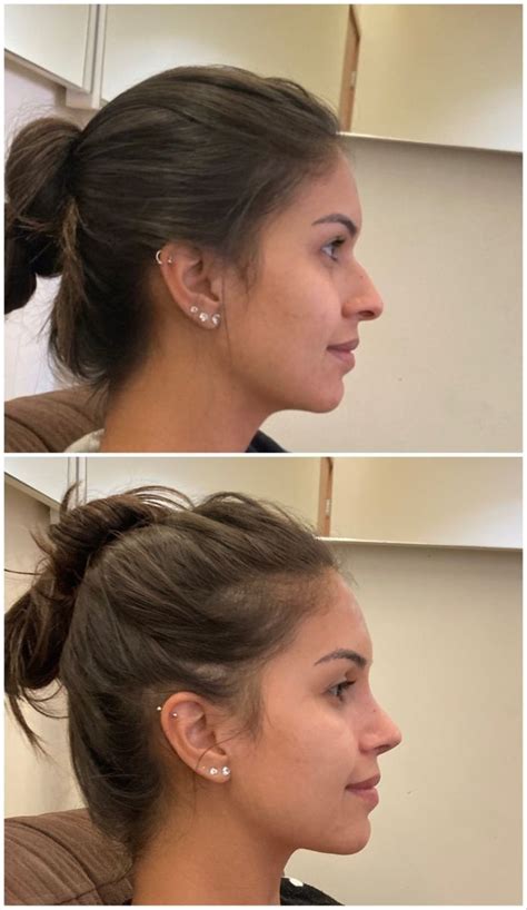 7 simple exercises to keep your nose in shape – Artofit