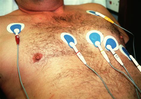 Ecg Electrodes Photograph by Antonia Reeve/science Photo Library - Fine ...
