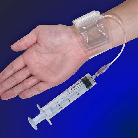 El Bileğinden Anjiyo ve Avantajları • Anjiyo Stent