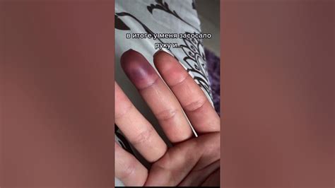 сломала палец - YouTube