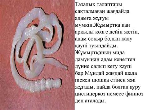 Гельминтоздар - презентация онлайн