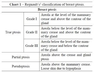If the Bra Fits...: The Accepted and Not Offensive Term is "Pendulous"