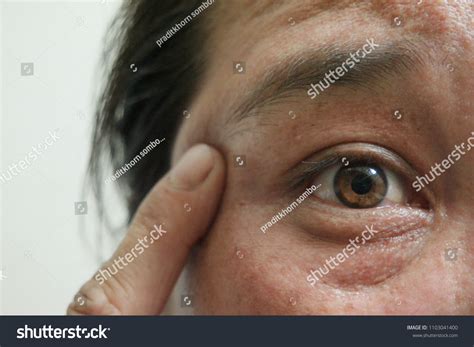 2,168 Acne Middle Aged Woman Images, Stock Photos & Vectors | Shutterstock