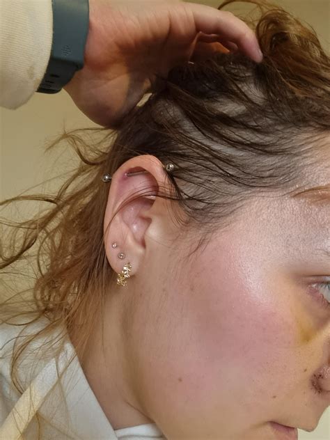 what kind of hair loss does this look like to you? : r/FemaleHairLoss