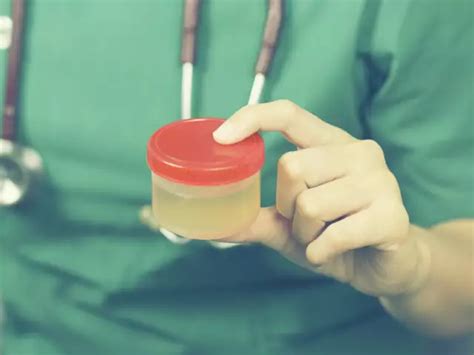 Urovant Sciences (UROV) | Business Insider India