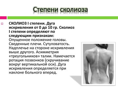 Профилактика и лечение нарушения осанки и сколиоза у детей ...