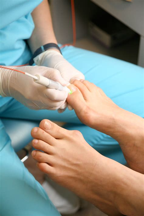 Лечение ногтей на ногах | Подолог | Dermatoloģijas klīnika