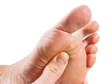 Corn Vs. Callus: Can You Tell The Difference?