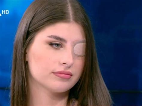 ФОТО: Исповед на 19 годишната Елеонора која го изгуби левото око во ...