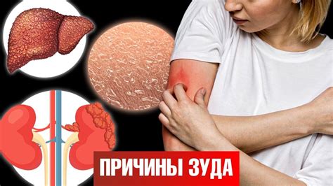 Чешутся руки до локтя и запястьях — причины, что делать