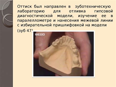 Ортопедическая стоматология. История болезни Трухачева В.Ю ...