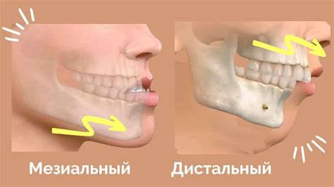 ЗУБ МУДРОСТИ! Как удаление 8-ок влияет на скулы, щеки, овал? Упражнение ...