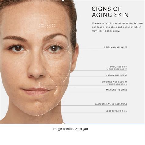 Understanding the Anatomy of Facial Aging Improves Natural Results ...