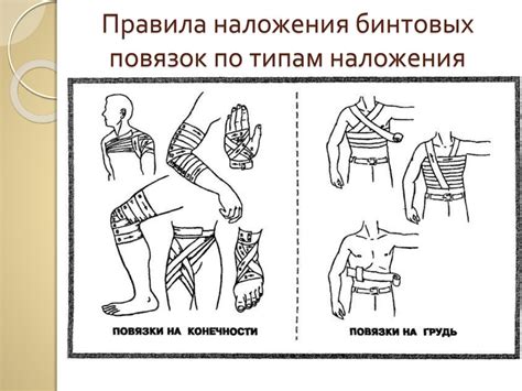 Правила наложения повязок и их разновидности - презентация онлайн