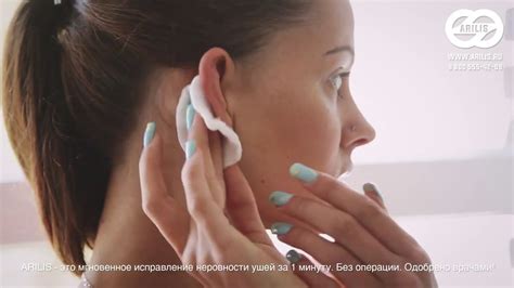 Отзывы об эстетических ушных корректорах Arilis - YouTube