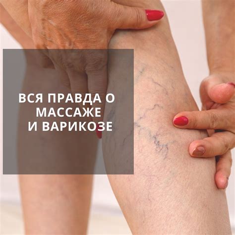 МОЖНО ЛИ ДЕЛАТЬ МАССАЖ ПРИ ВАРИКОЗЕ?... - Массаждляздоровья
