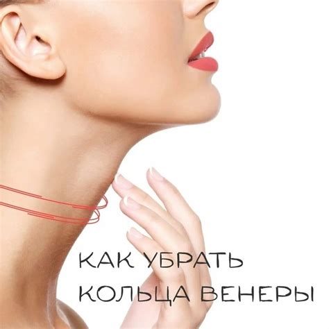 Кольца Венеры - что это и как убрать? “Кольца Венеры” – это поперечные ...