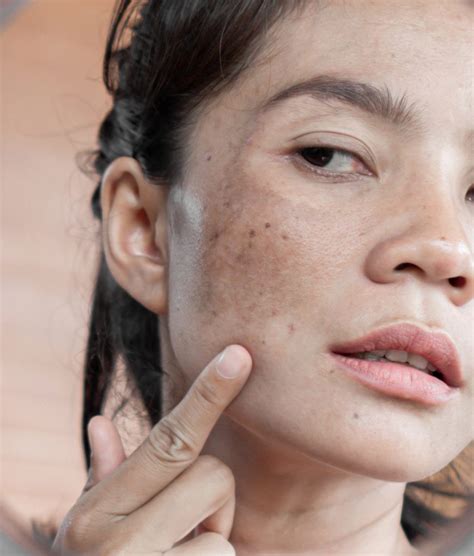 Sun-damaged Skin Treatments | Mesa, AZ | Sagebrush Dermatology
