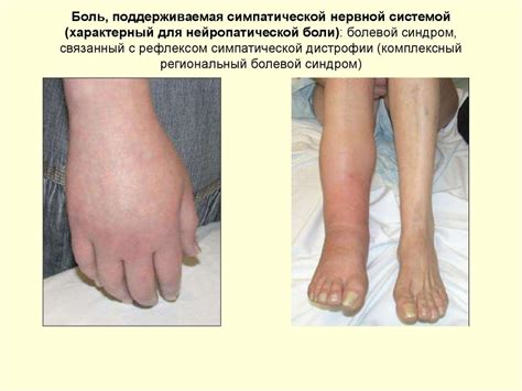 Понятие боли - презентация онлайн