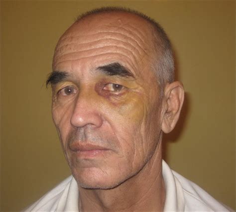 Azimzhan Askarov - Alchetron, The Free Social Encyclopedia