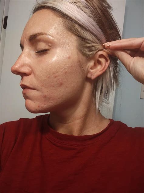 HELP 😭 I literally don't know what I'm doing wrong : r/tretinoin