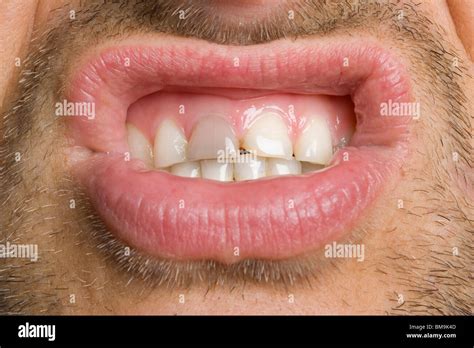 Mouth and teeth Stock Photo - Alamy