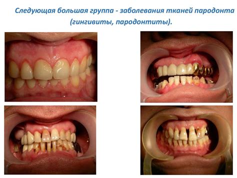 «Распространенность и интенсивность основных стоматологических ...