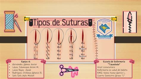 Tipos De Sutura Odontologia - BRAINCP