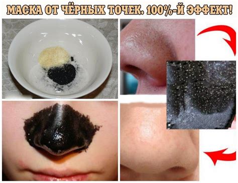 Всё самое интересное!: МАСКА ОТ ЧЁРНЫХ ТОЧЕК. 100%-Й ЭФФЕКТ!