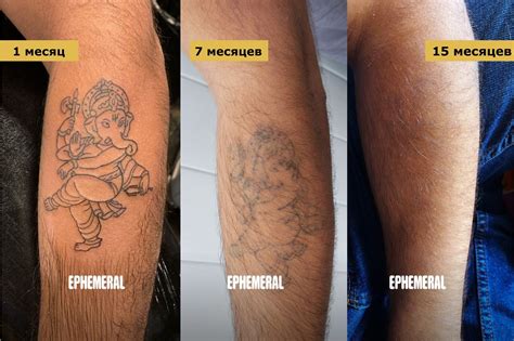Исчезающие татуировки - исчезают или нет? | FUNTATTOO.ru